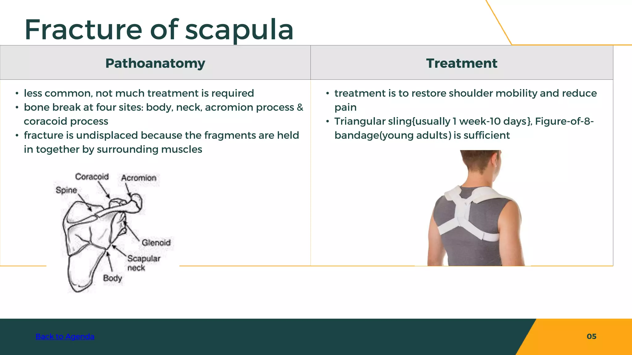 shoulder injury.pptx