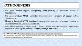 Wilson's Disease | PDF