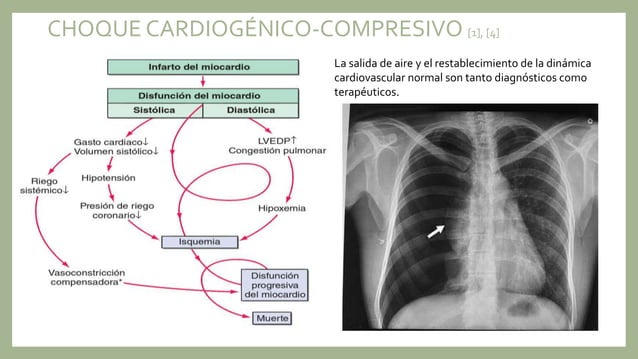Sindrome de Choque.pptx