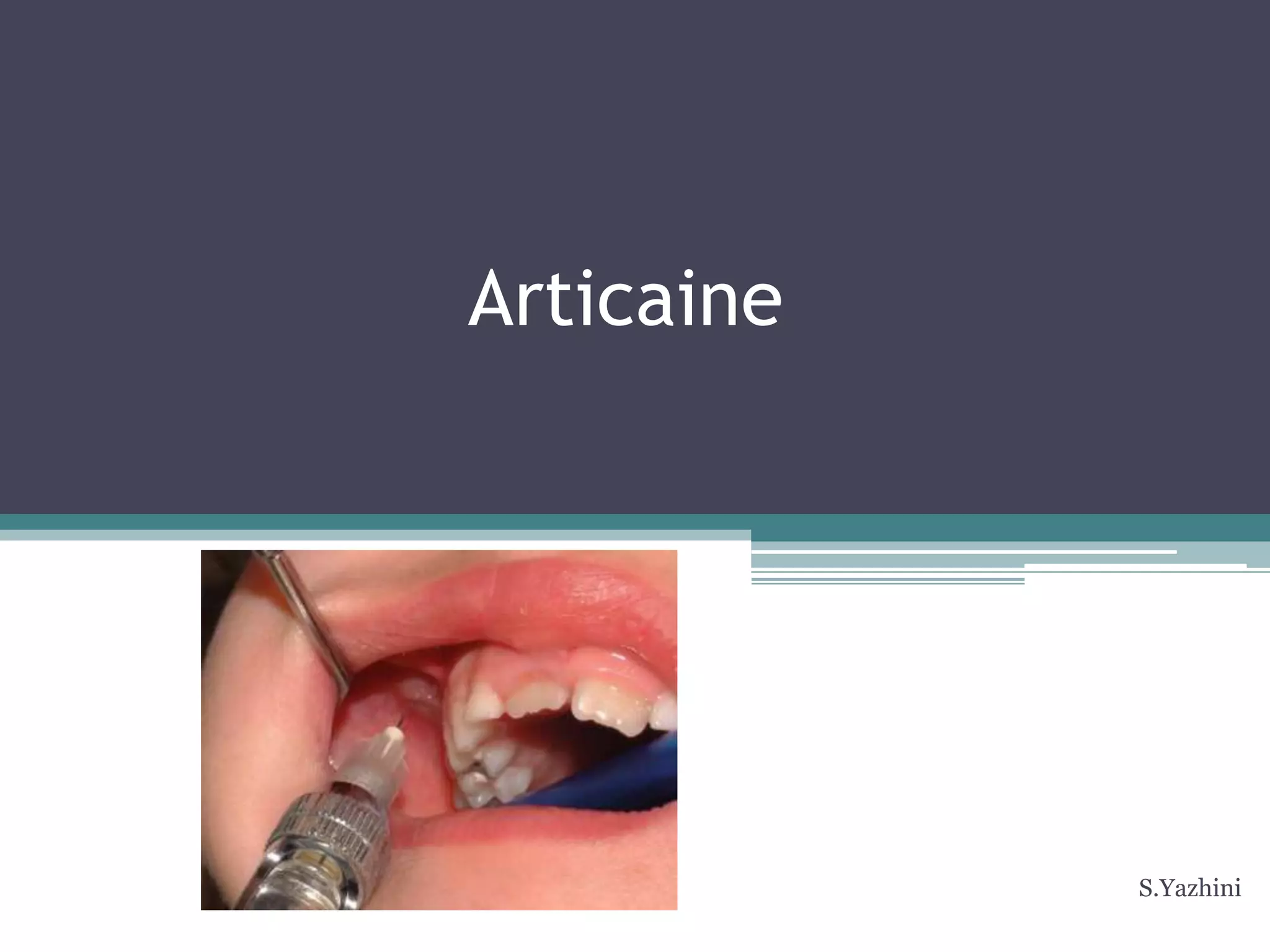 articaine.pptx