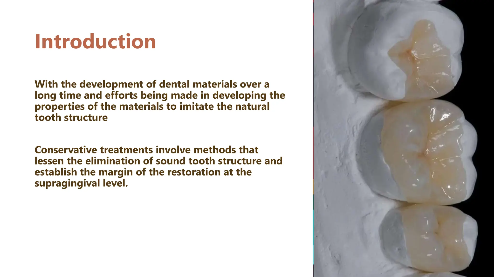PARTIAL BONDED RESTORATIONS AND IT’S ADHESION.pptx