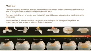 PARTIAL BONDED RESTORATIONS AND IT’S ADHESION.pptx
