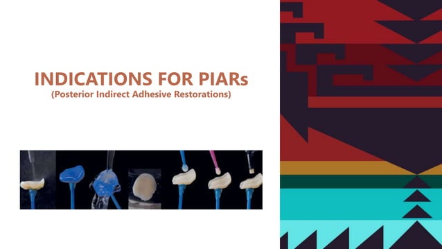 PARTIAL BONDED RESTORATIONS AND IT’S ADHESION.pptx
