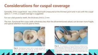 PARTIAL BONDED RESTORATIONS AND IT’S ADHESION.pptx