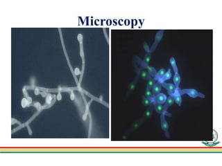 12. Fungal identification methods-New.ppt