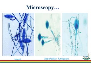 12. Fungal identification methods-New.ppt