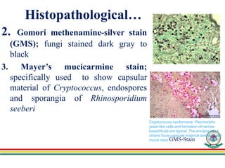 12. Fungal identification methods-New.ppt