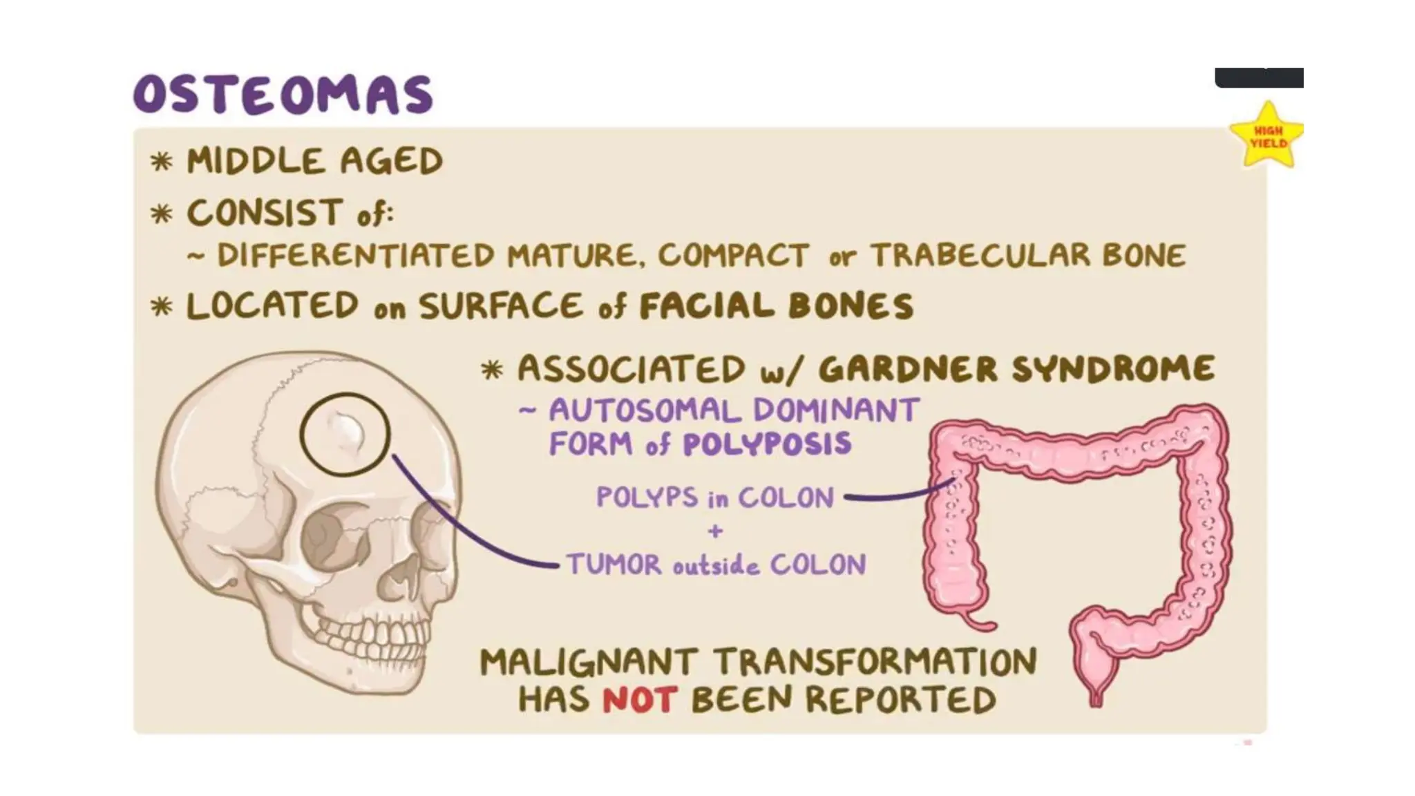 Osteoid Osteoma and Osteoid sarcoma.pptx