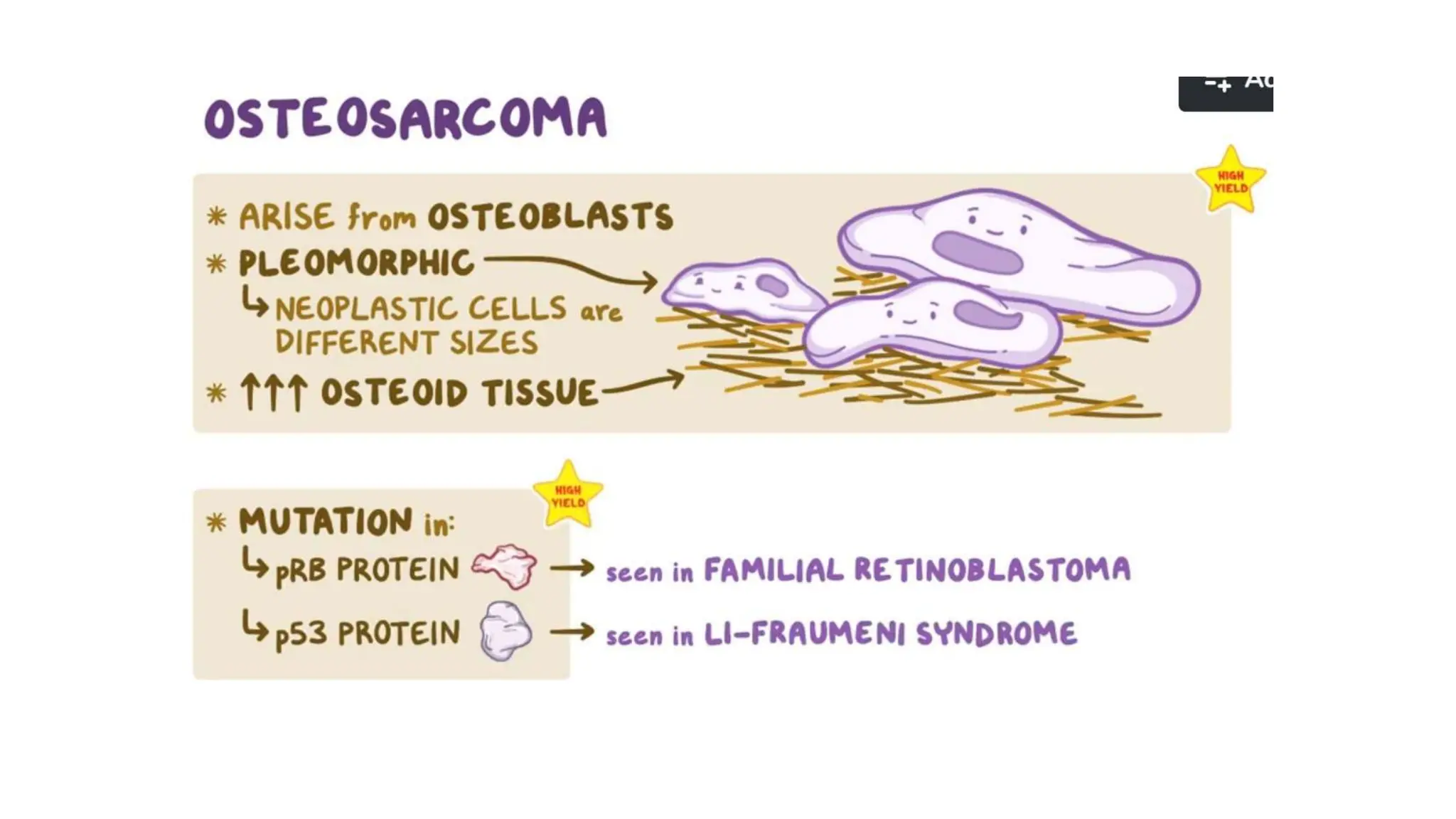 Osteoid Osteoma and Osteoid sarcoma.pptx