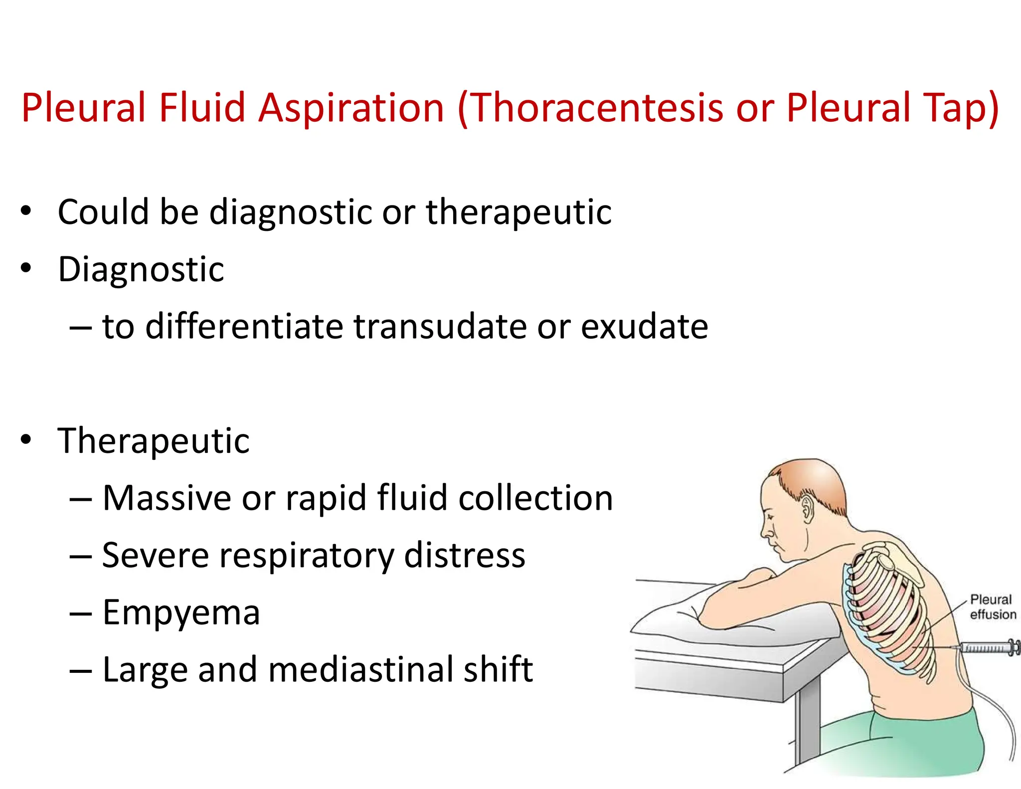 Pleural Effusion and its pathophysiology | PDF