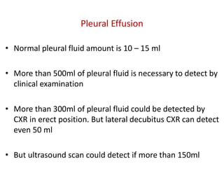 Pleural Effusion and its pathophysiology | PDF