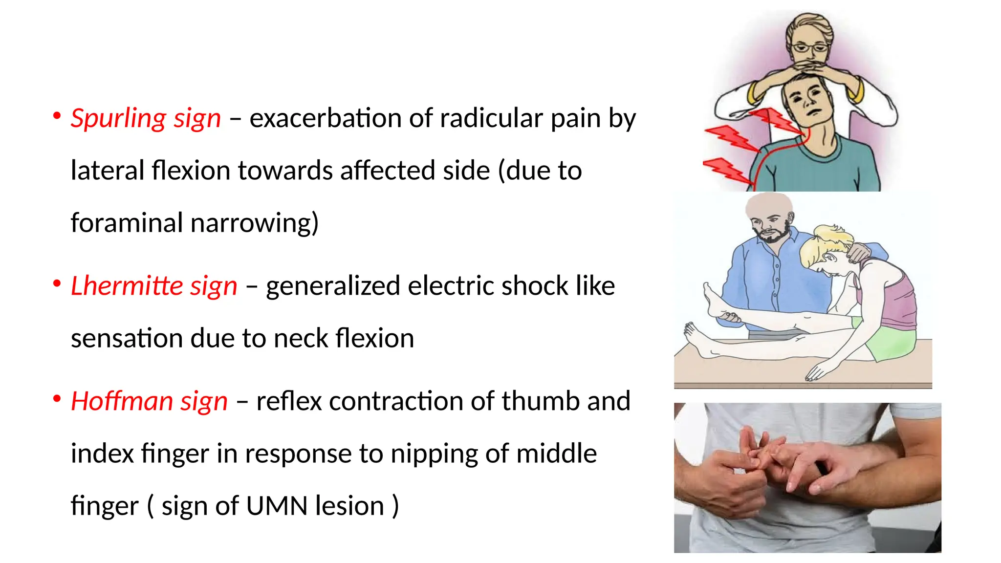 Cervical Spondylosis (Nutshell) with pictures | PPTX