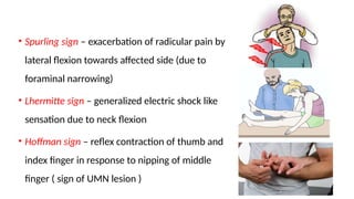 Cervical Spondylosis (Nutshell) with pictures | PPTX
