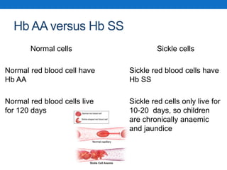 12. Sickle Cell Disease 2020.pdf Hassanl | PPT