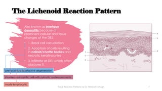 Tissue Reaction Patterns in Dermatopathology | PPTX