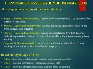 OSTEOMYELITIS IN ORAL AND MAXILLOFACIAL SURGERY | PPTX
