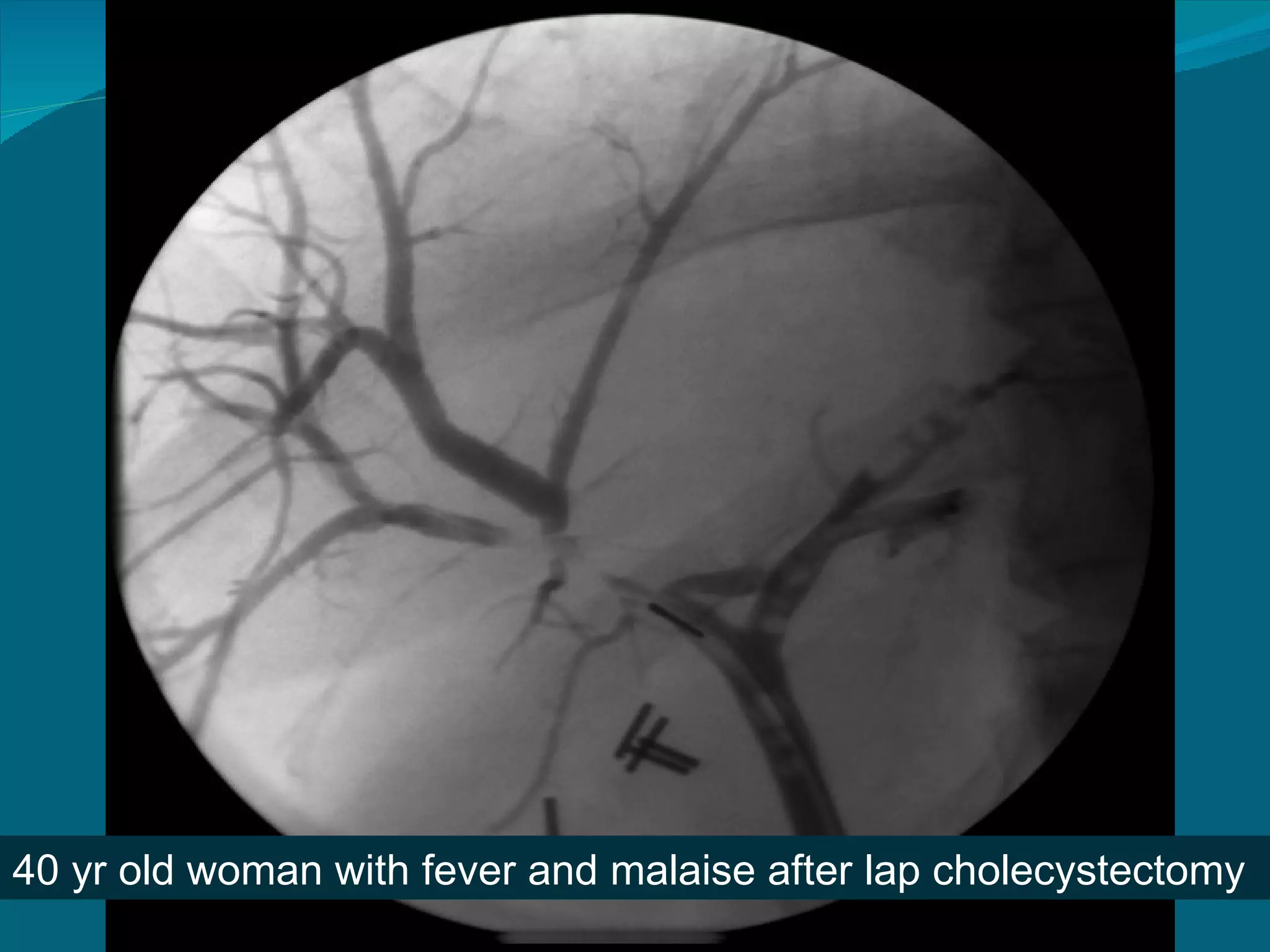 Endoscopy in Gastrointestinal Oncology - Slide 12 - J. Baillie ...