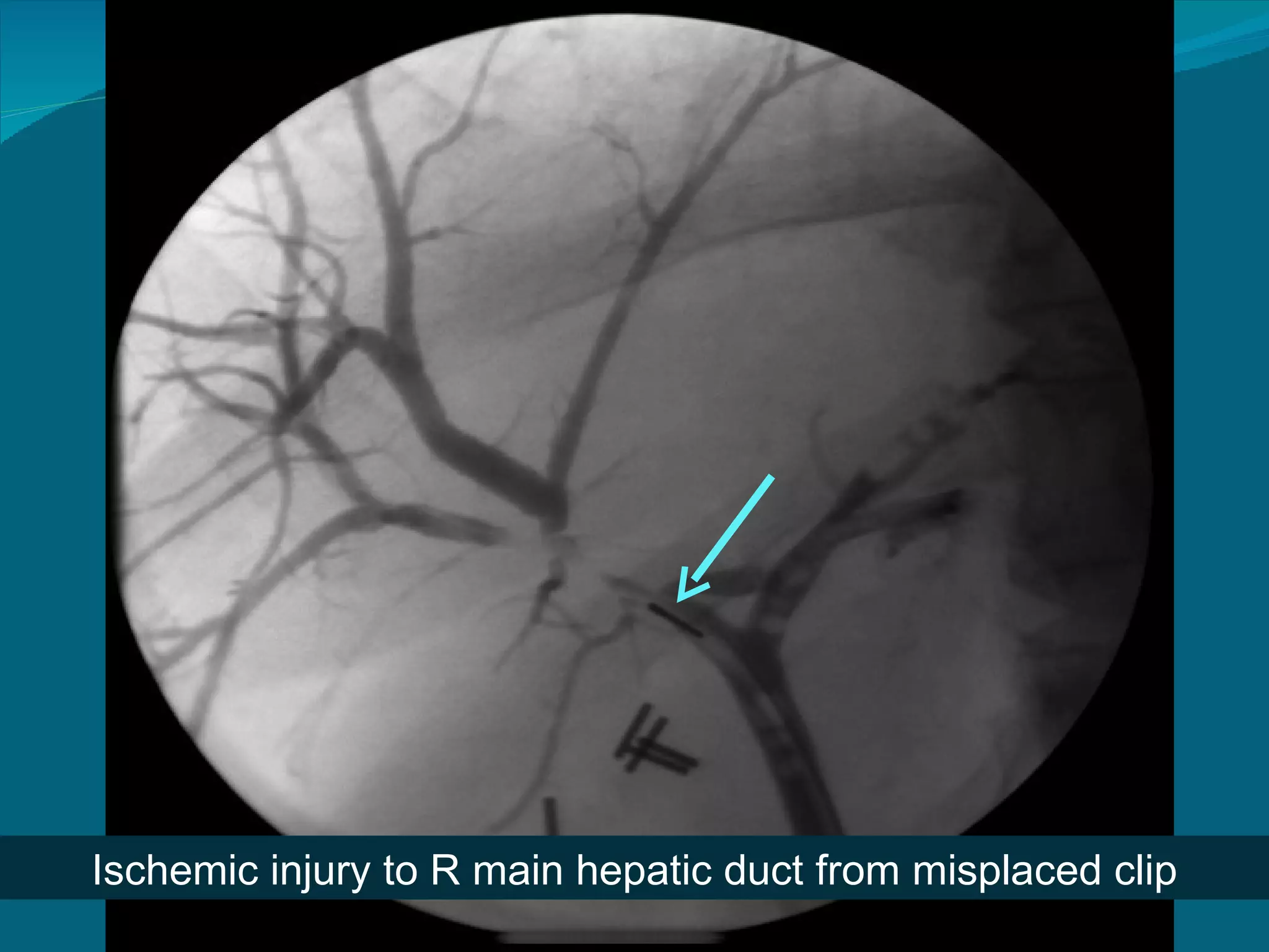 Endoscopy in Gastrointestinal Oncology - Slide 12 - J. Baillie ...
