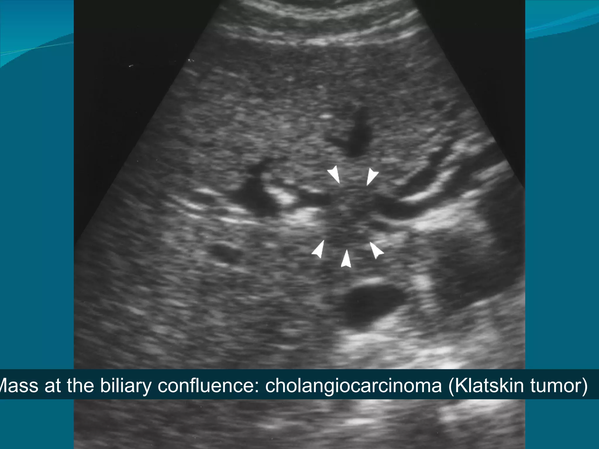 Endoscopy in Gastrointestinal Oncology - Slide 12 - J. Baillie ...