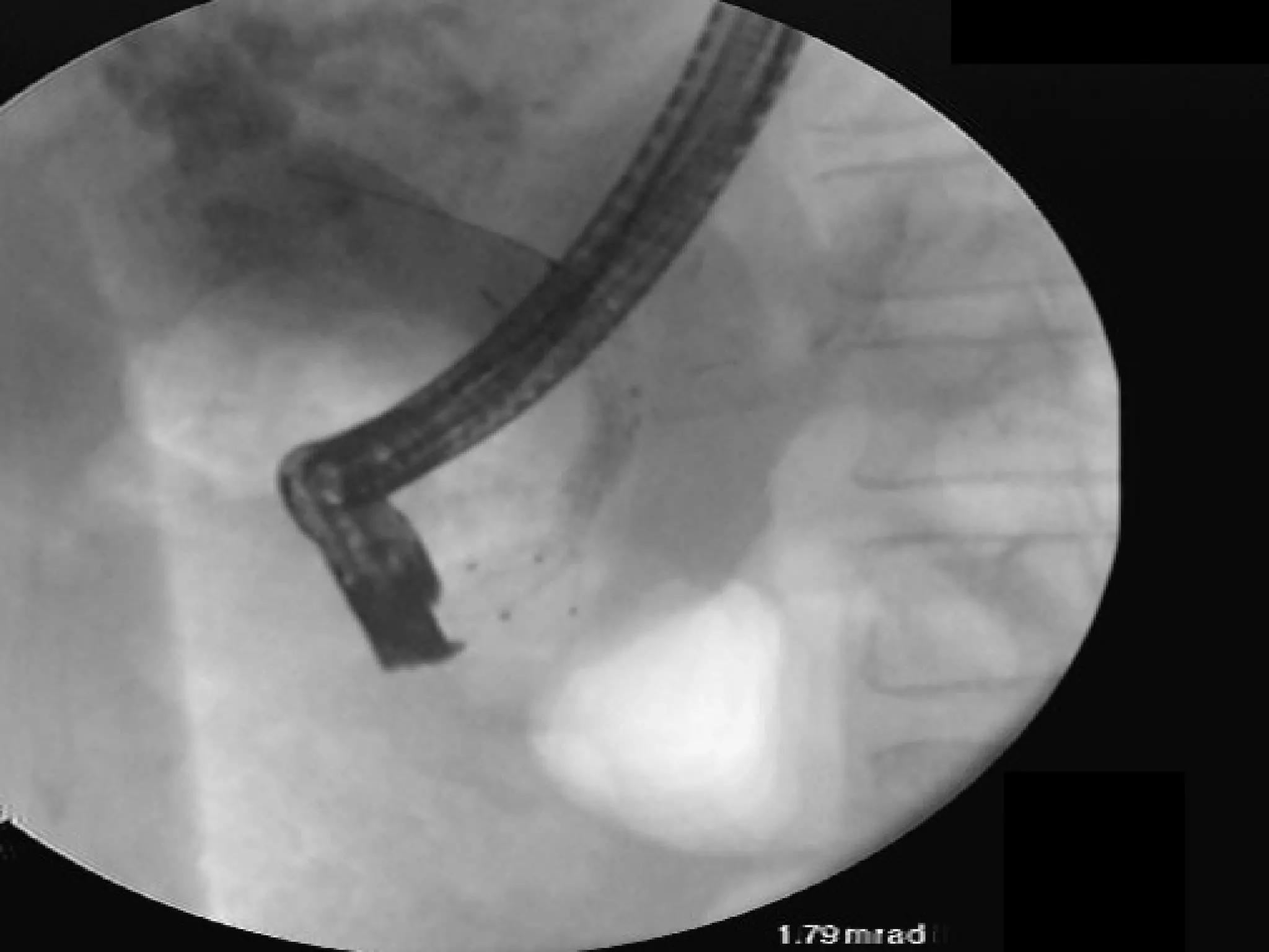 Endoscopy in Gastrointestinal Oncology - Slide 12 - J. Baillie ...