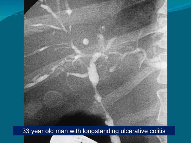 Endoscopy in Gastrointestinal Oncology - Slide 12 - J. Baillie ...