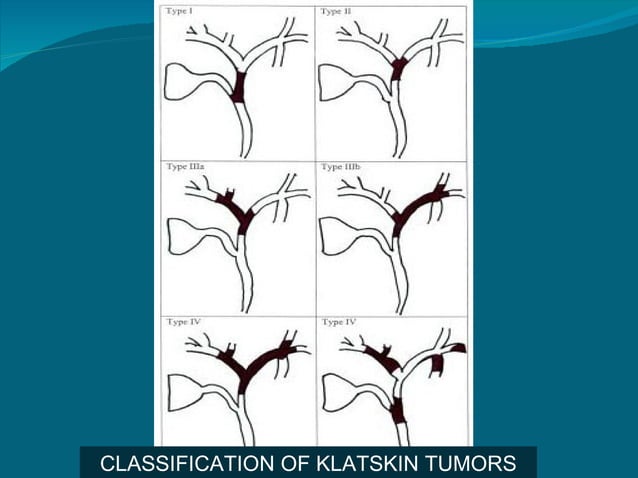Endoscopy in Gastrointestinal Oncology - Slide 12 - J. Baillie ...
