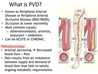 12 - cardiovascular diseases - Part 3.ppt