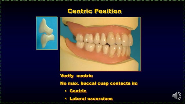 12- Denture processing and laboratory errors | PPTX | Dental Health | Diseases and Conditions