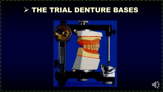 12- Denture processing and laboratory errors | PPTX | Dental Health | Diseases and Conditions