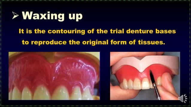 12- Denture processing and laboratory errors | PPTX | Dental Health | Diseases and Conditions