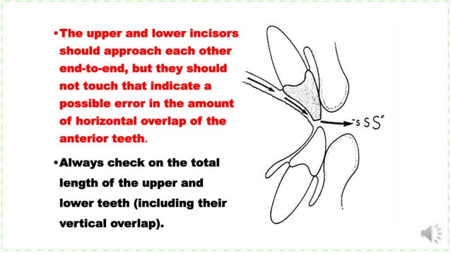 12- Denture processing and laboratory errors | PPTX | Dental Health | Diseases and Conditions