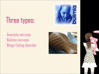 12 eating disorders | PPT
