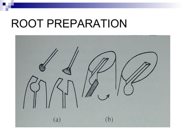 12 endodontic surgical procedures | PPT