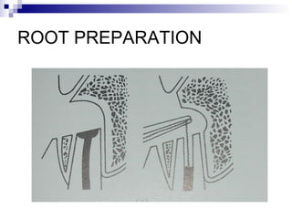 12 endodontic surgical procedures | PPT