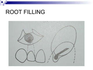 12 endodontic surgical procedures | PPT