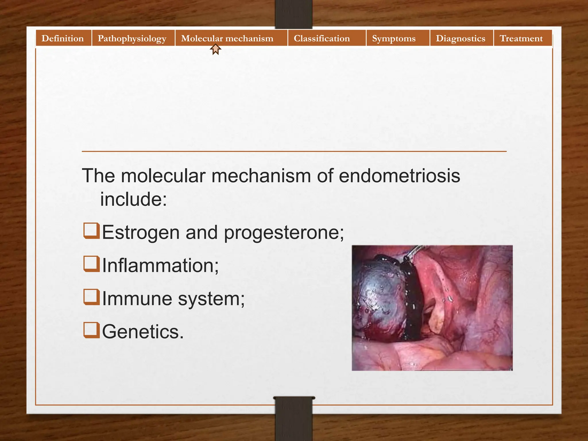 12-------+++++++++++++ Endometriosis.pptx | Pregnancy | Reproductive Health