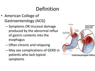 Lecture note on GERD and peptic ulcer.ppt