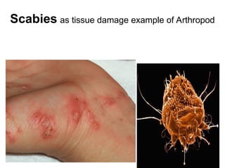 12- helminths and Arthropodes parasites.ppt