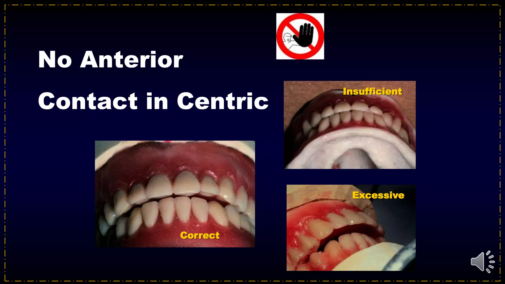 12- Denture Processing and Laboratory Errors. | PPTX