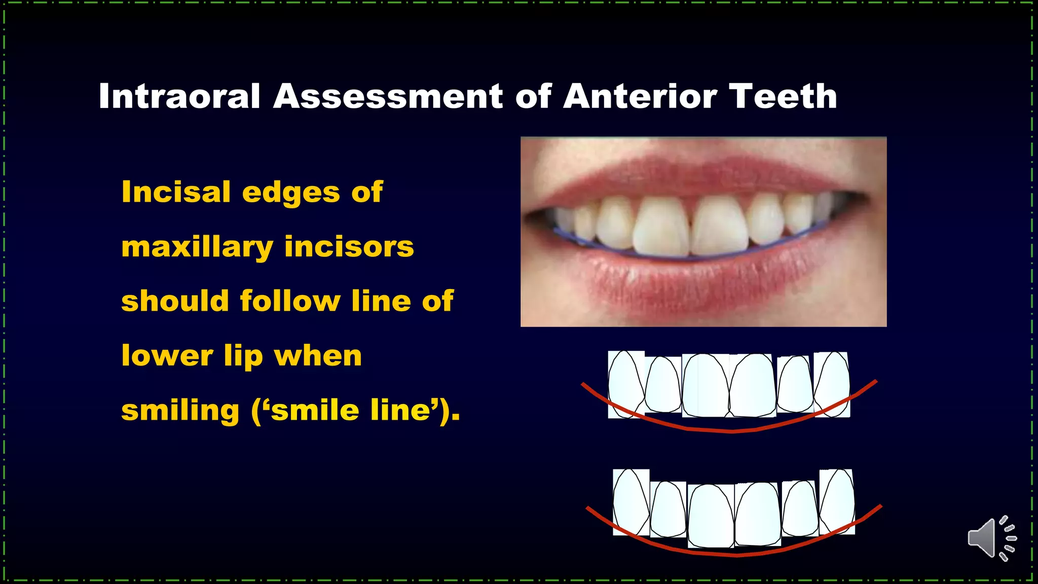 12- Denture Processing and Laboratory Errors. | PPTX