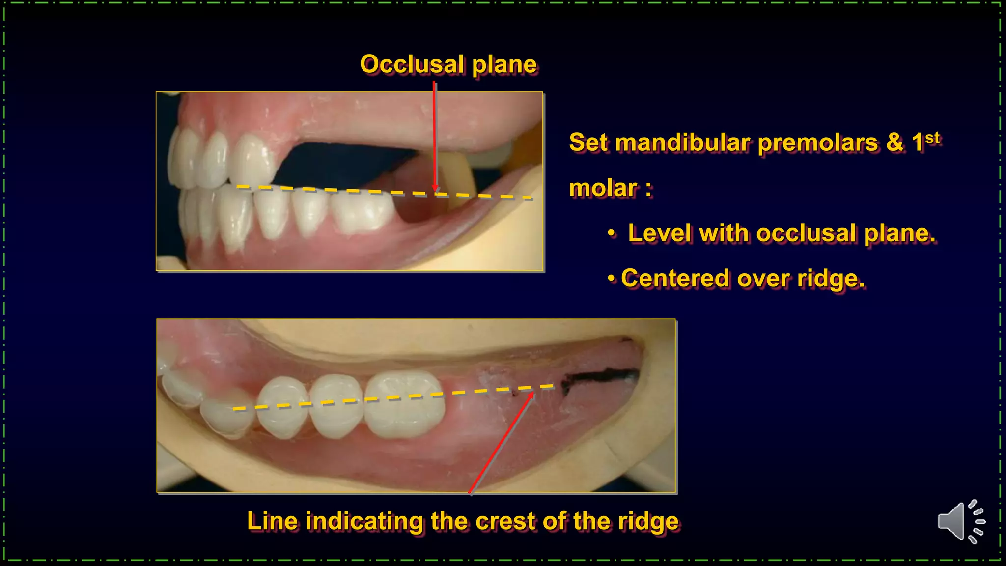 12- Denture Processing and Laboratory Errors. | PPTX