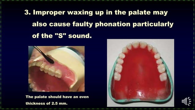 12- Denture Processing and Laboratory Errors. | PPTX