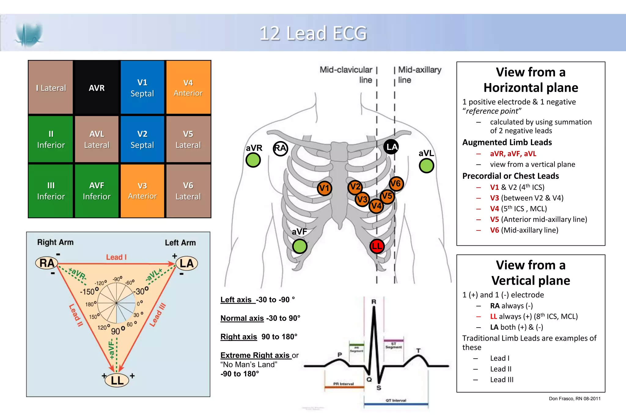12 LEAD Handout | PDF