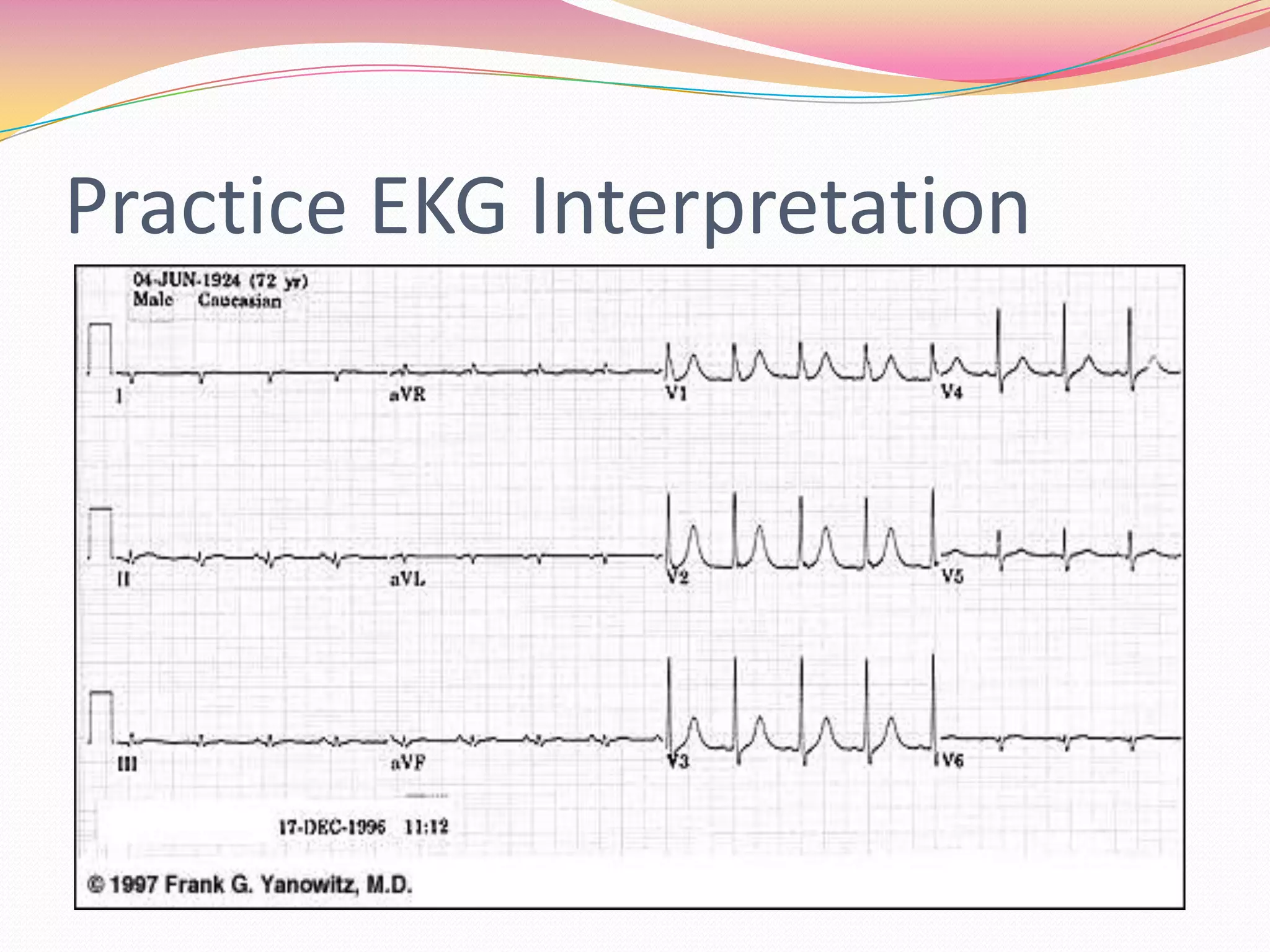 12 Lead EKG Interpretation | PPTX