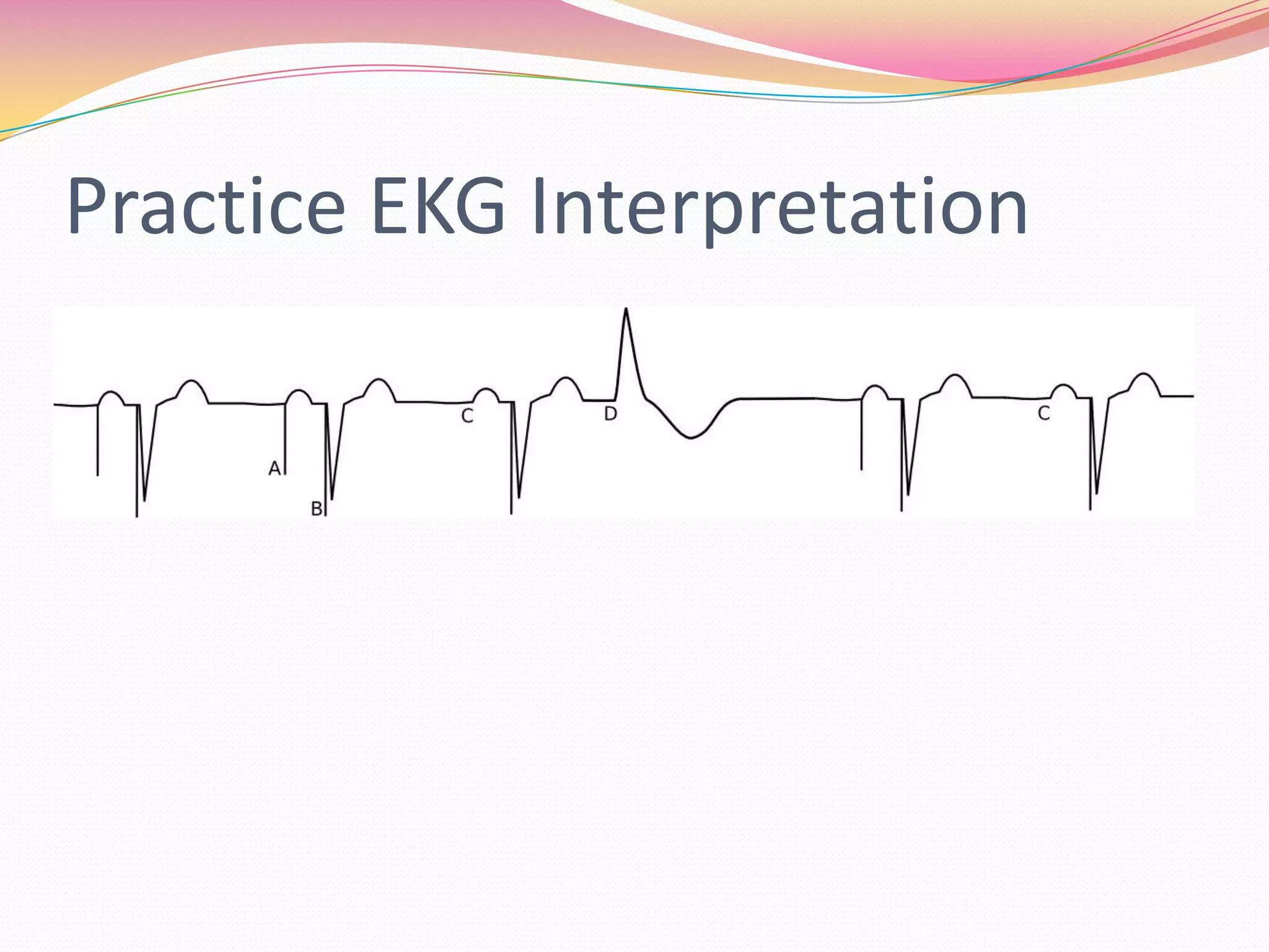 12 Lead EKG Interpretation | PPTX