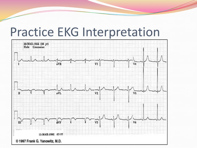 12 Lead EKG Interpretation | PPTX | Heart and Cardiovascular Diseases ...