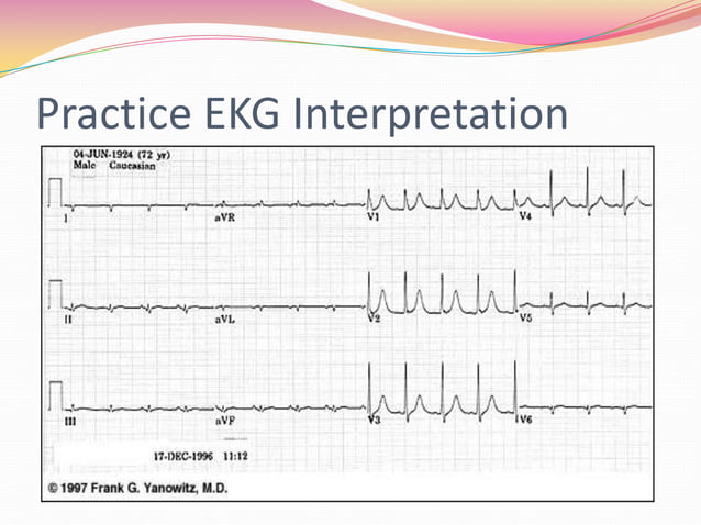 12 Lead EKG Interpretation | PPTX | Heart and Cardiovascular Diseases ...