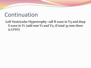 12 Lead EKG Interpretation | PPTX