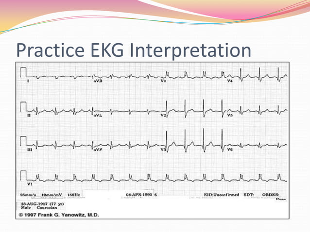 12 Lead EKG Interpretation