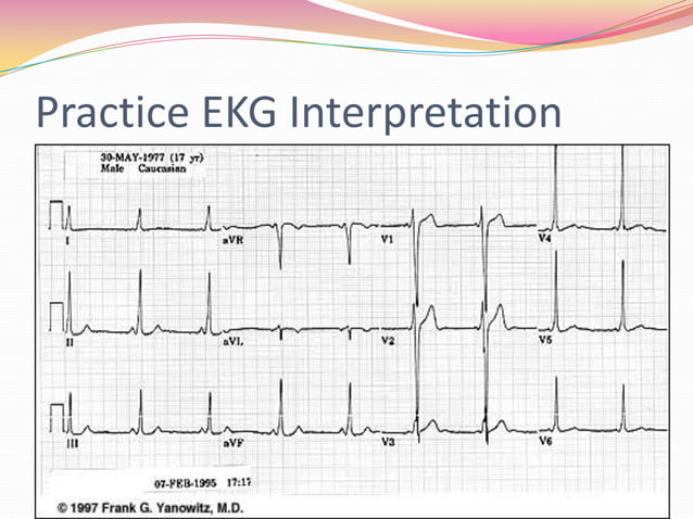 12 Lead EKG Interpretation